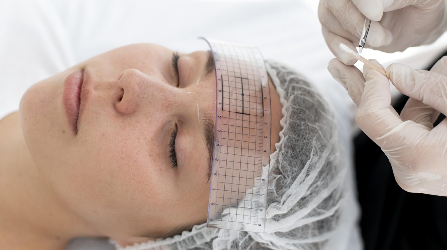 Face Treatments | Thread Lifting & Contouring